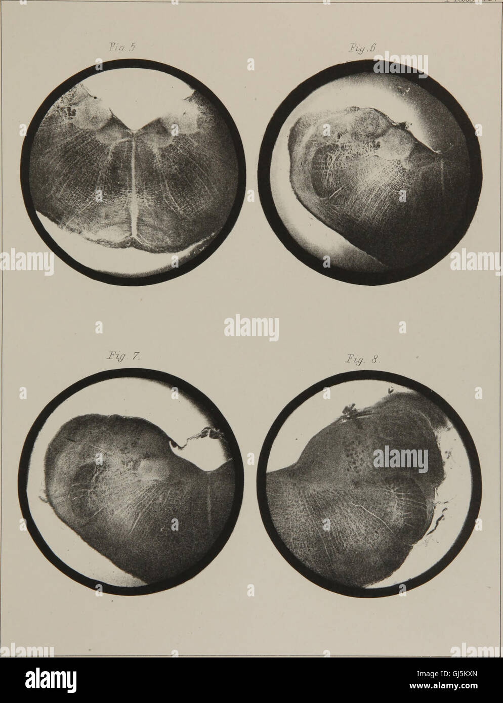 This 1864 study explores the structure and functions of the gray matter ...