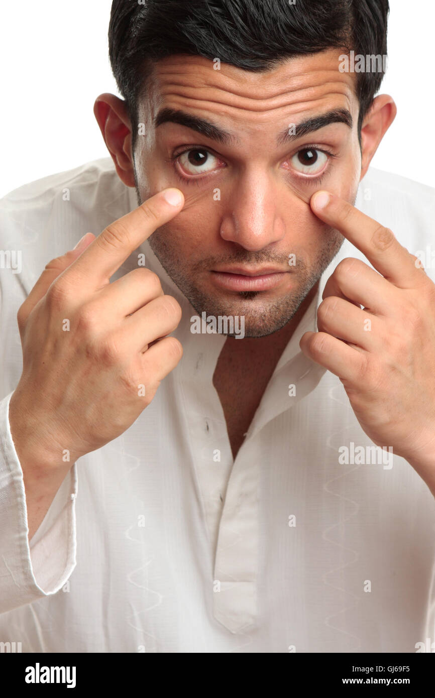 Bloodshot High Resolution Stock Photography and Images - Alamy