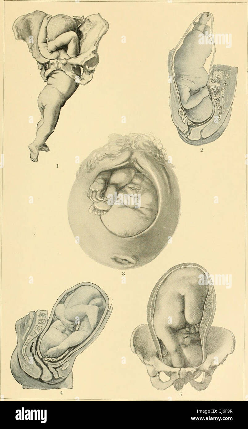 'An American Text-Book of Obstetrics' (1897) is a comprehensive medical ...