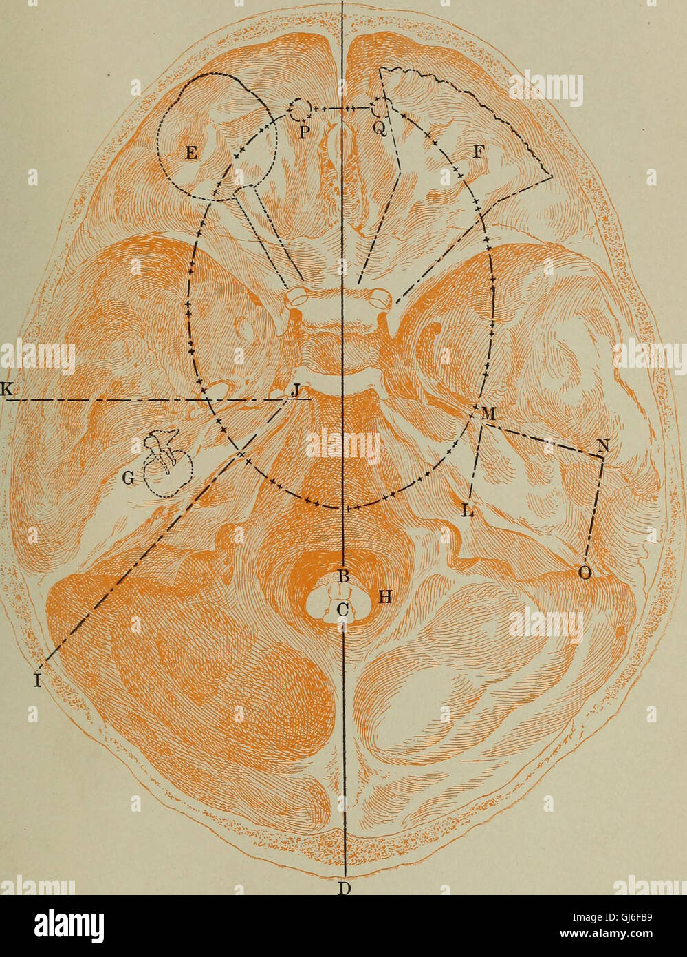Postmortem pathology; a manual of the technic of post-mortem ...