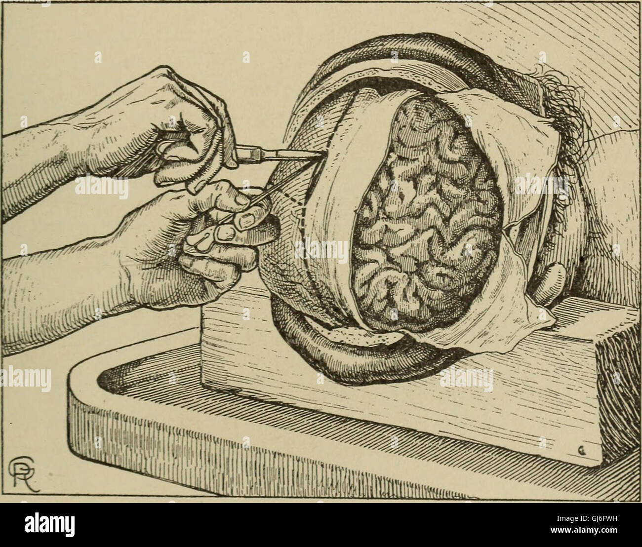 Post-mortem pathology; a manual of post-mortem examinations and the ...