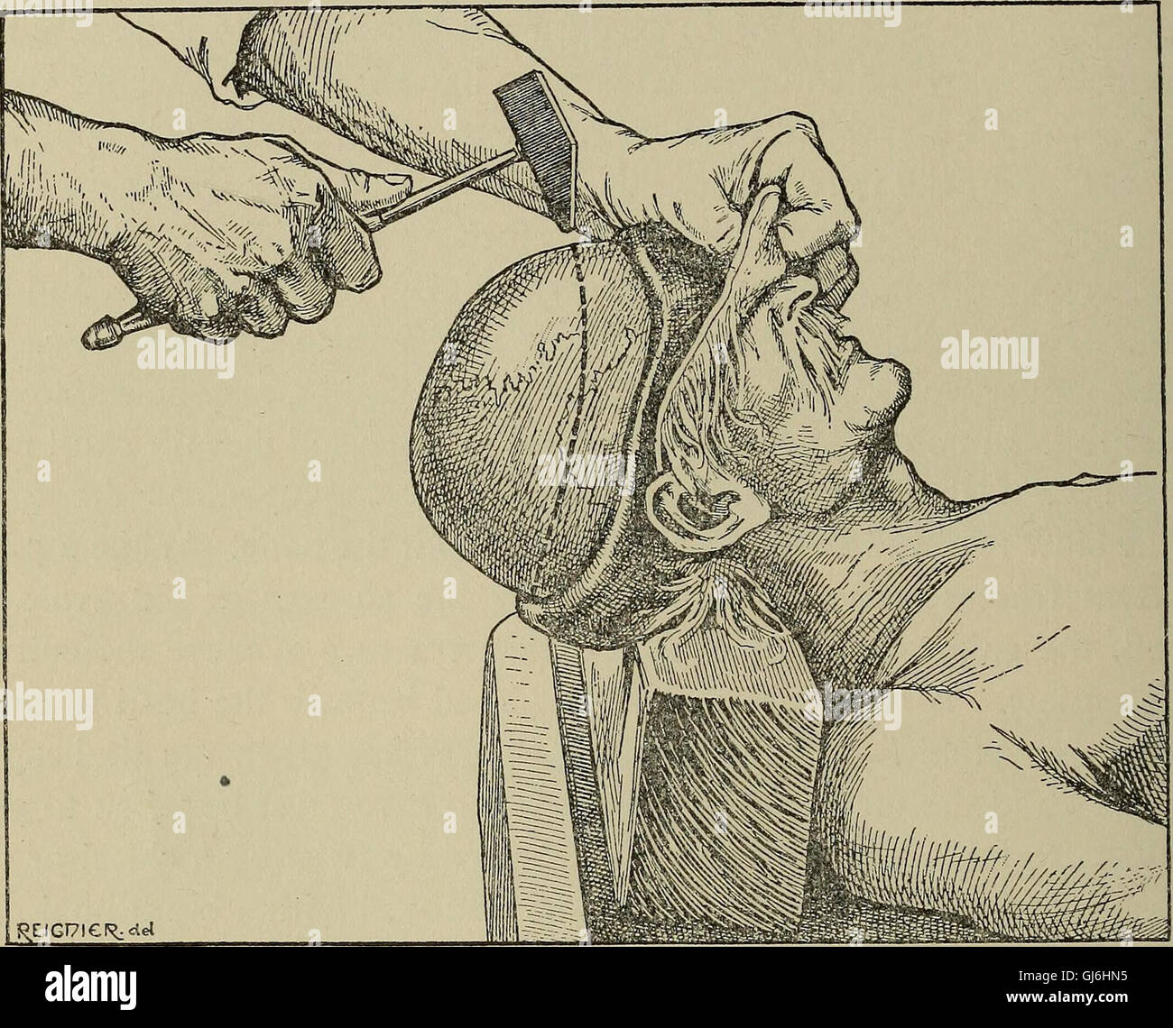 'Postmortem Pathology' (1906) provides a detailed guide to conducting ...