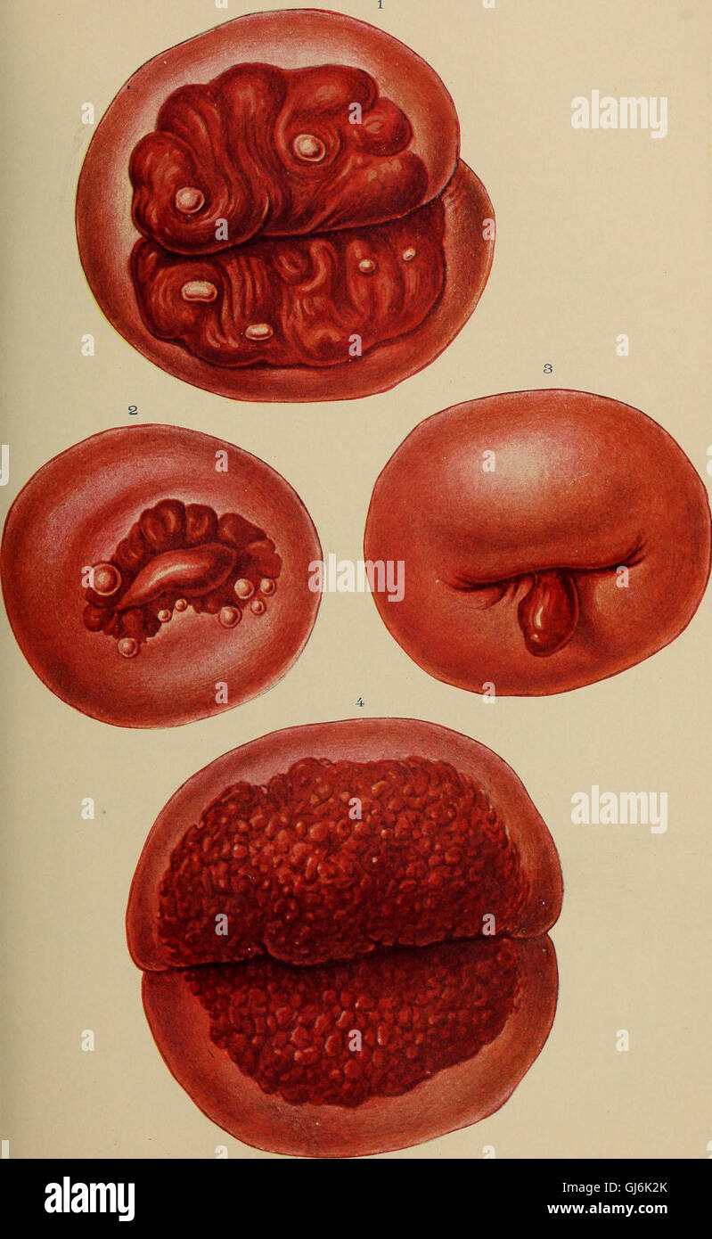 'The Diagnosis of Diseases of Women' (1905) is a medical text that ...