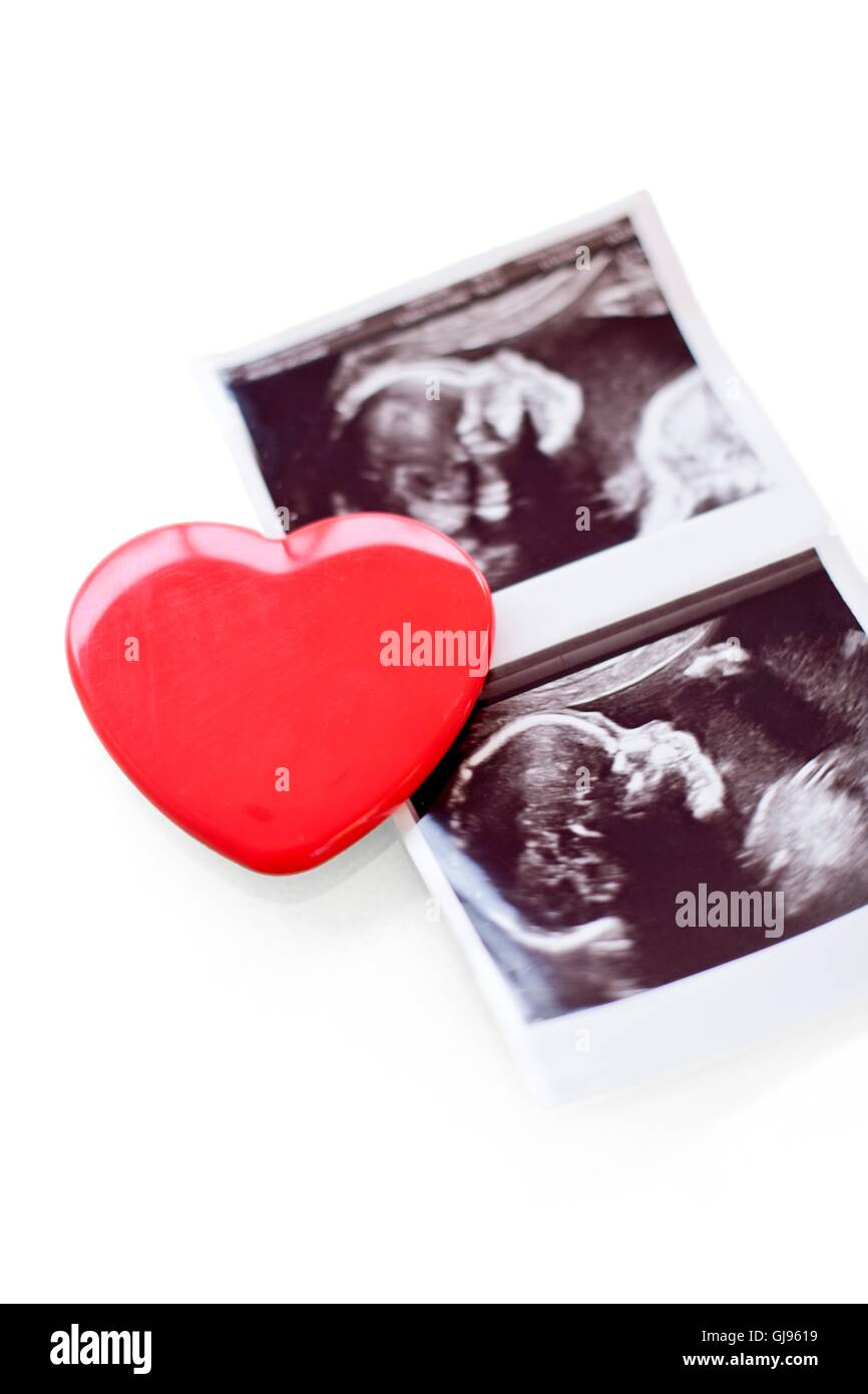 Animal fetus photos hi-res stock photography and images - Alamy