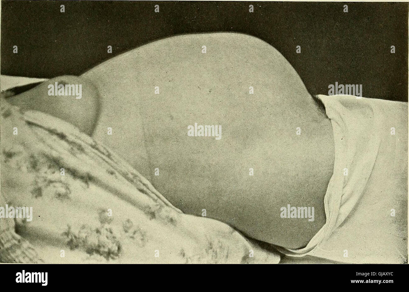 This 1918 medical text on gynecology provides a comprehensive overview ...