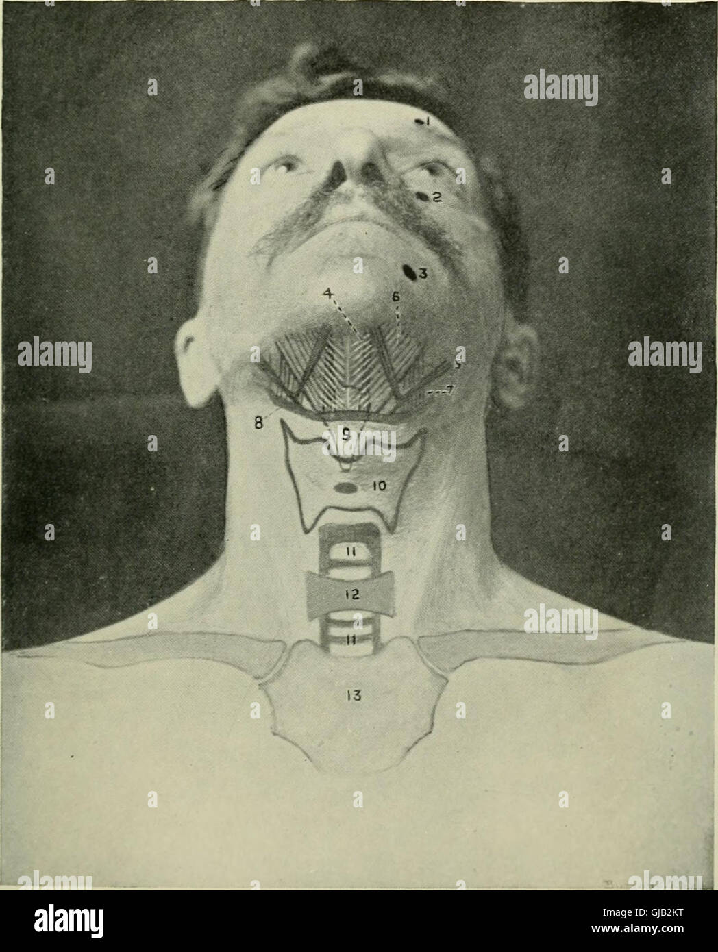 Landmarks and surface markings of the human body (1913 Stock Photo - Alamy