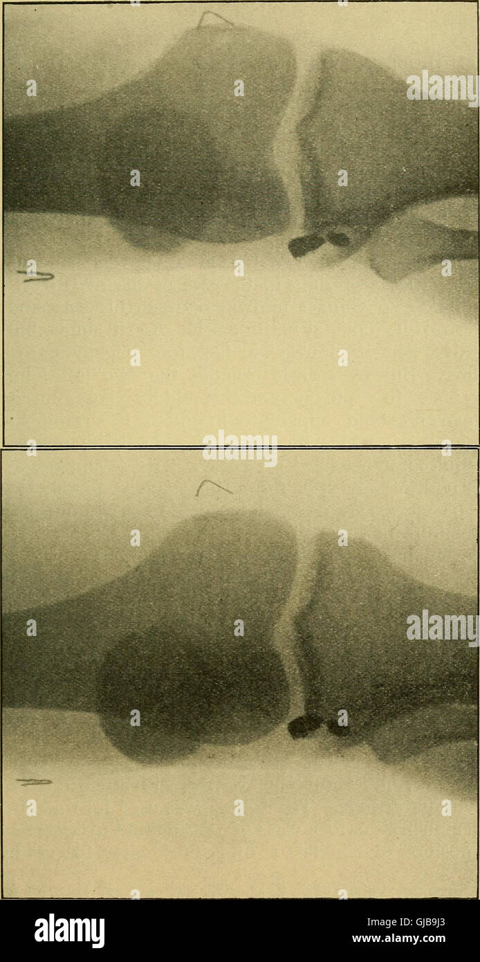 'Wounds in War' (1910) explores the nature of war-related injuries, the ...