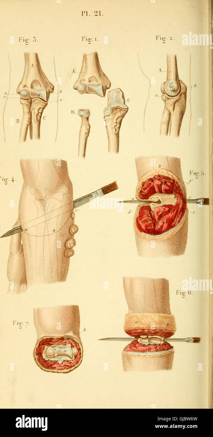 *A Textbook of Operative Surgery and Surgical Anatomy* (1878) is a ...