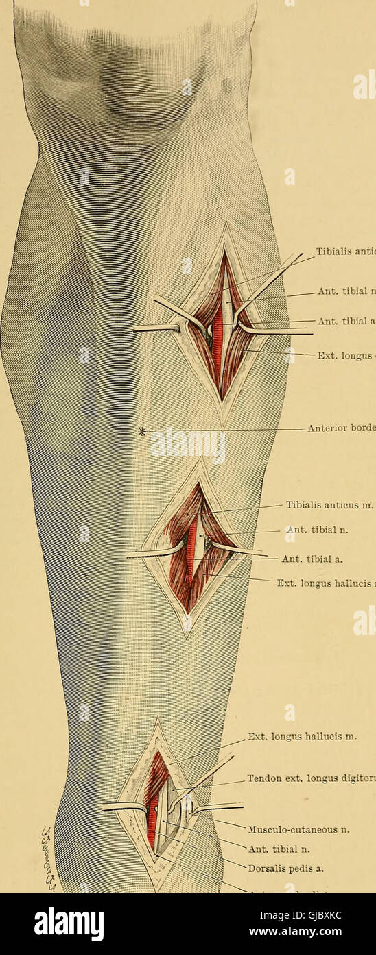 *Text-Book of Operative Surgery* (1903) is a comprehensive guide on ...