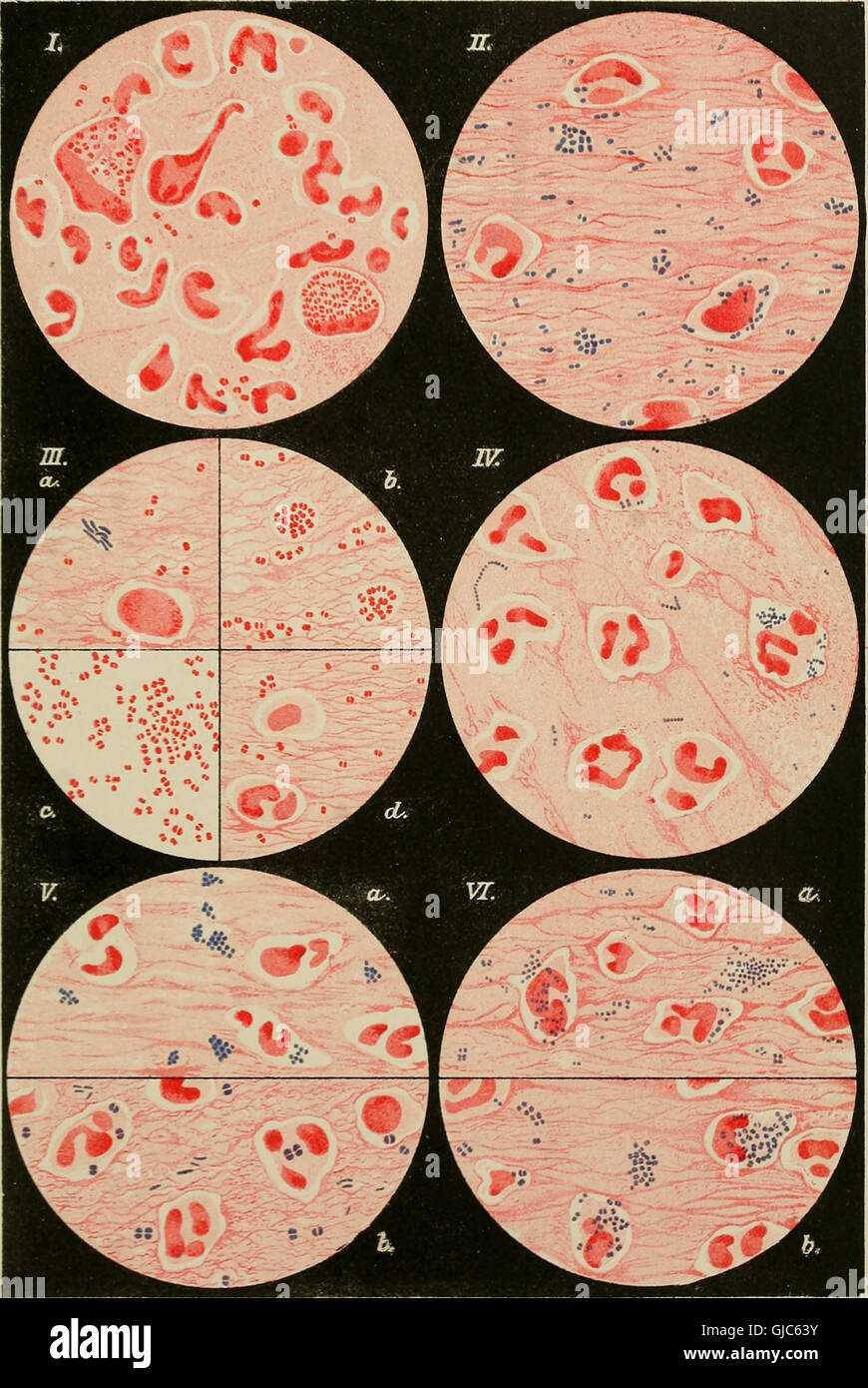 'The Bacteriology of the Eye' (1908) discusses the role of bacteria in ...
