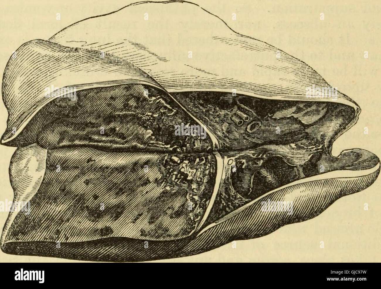 Manual of pathological anatomy (1875 Stock Photo - Alamy