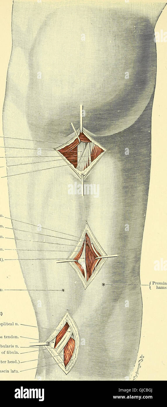 The 'Text-book of Operative Surgery' (1911) is a detailed reference ...