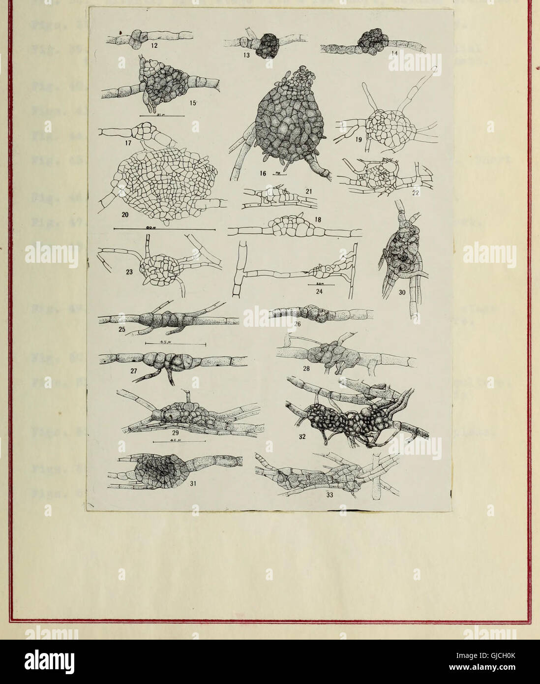 This 1918 work explores the Pycnidium, a structure in fungi, detailing ...