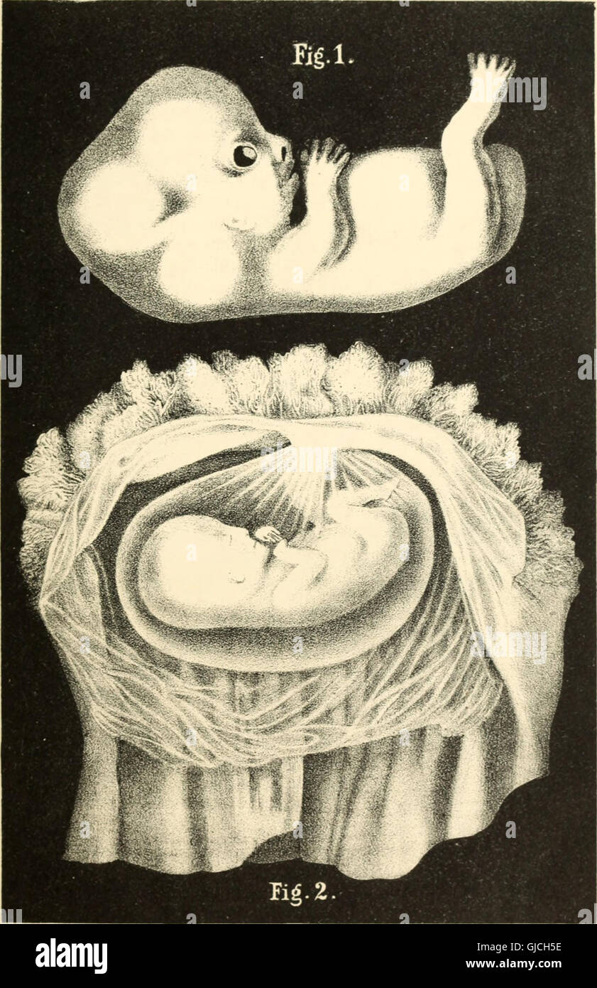 A 1897 book titled 'The Science and Art of Midwifery', providing ...