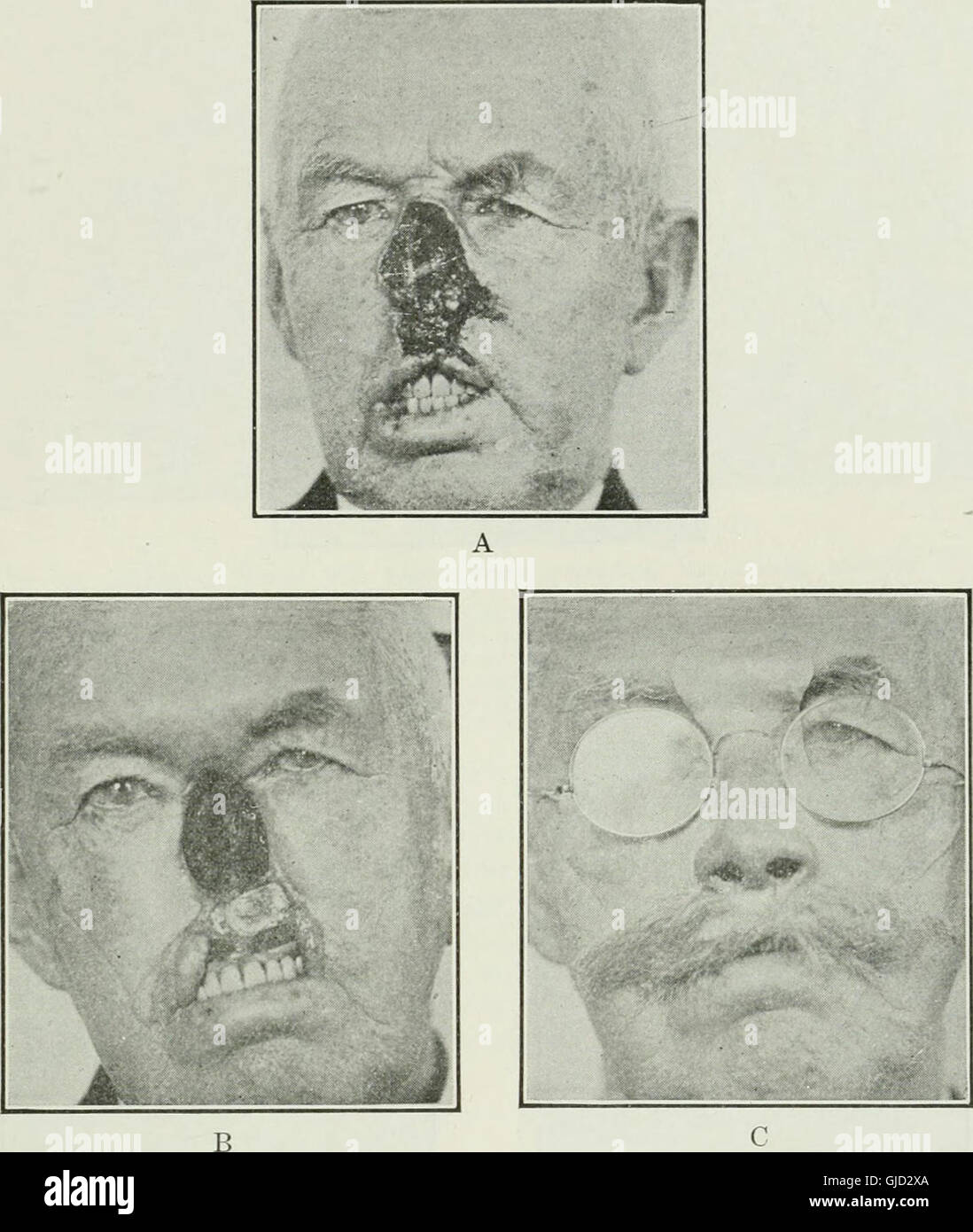 The 1913 publication on radium explores its discovery, properties, and ...