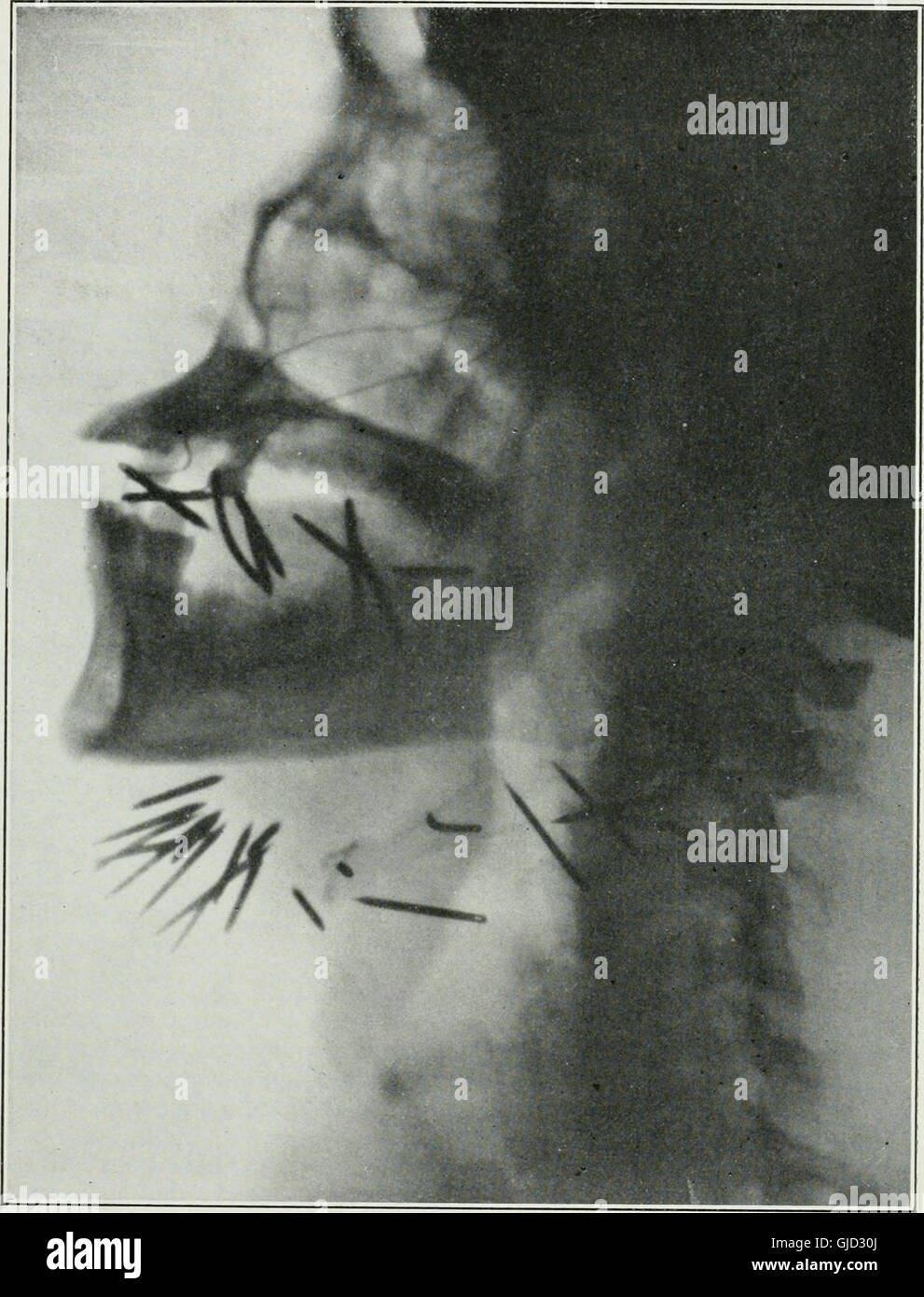 This 1913 publication provides an overview of radium, its discovery ...
