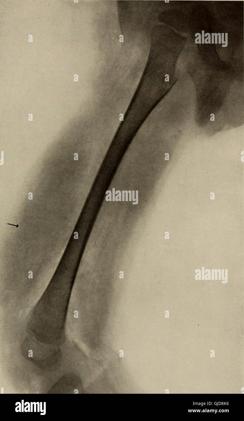 This 1910 work provides a comprehensive look at living anatomy and ...