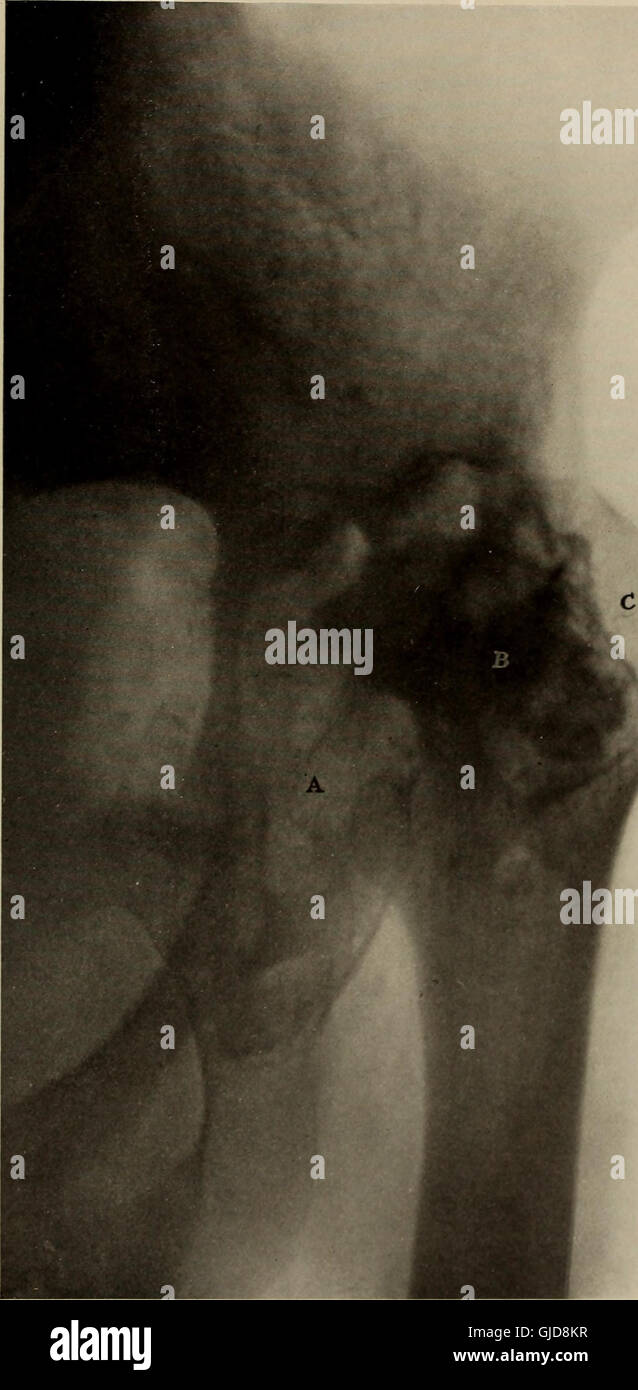 This 1910 publication on living anatomy and pathology covers the ...