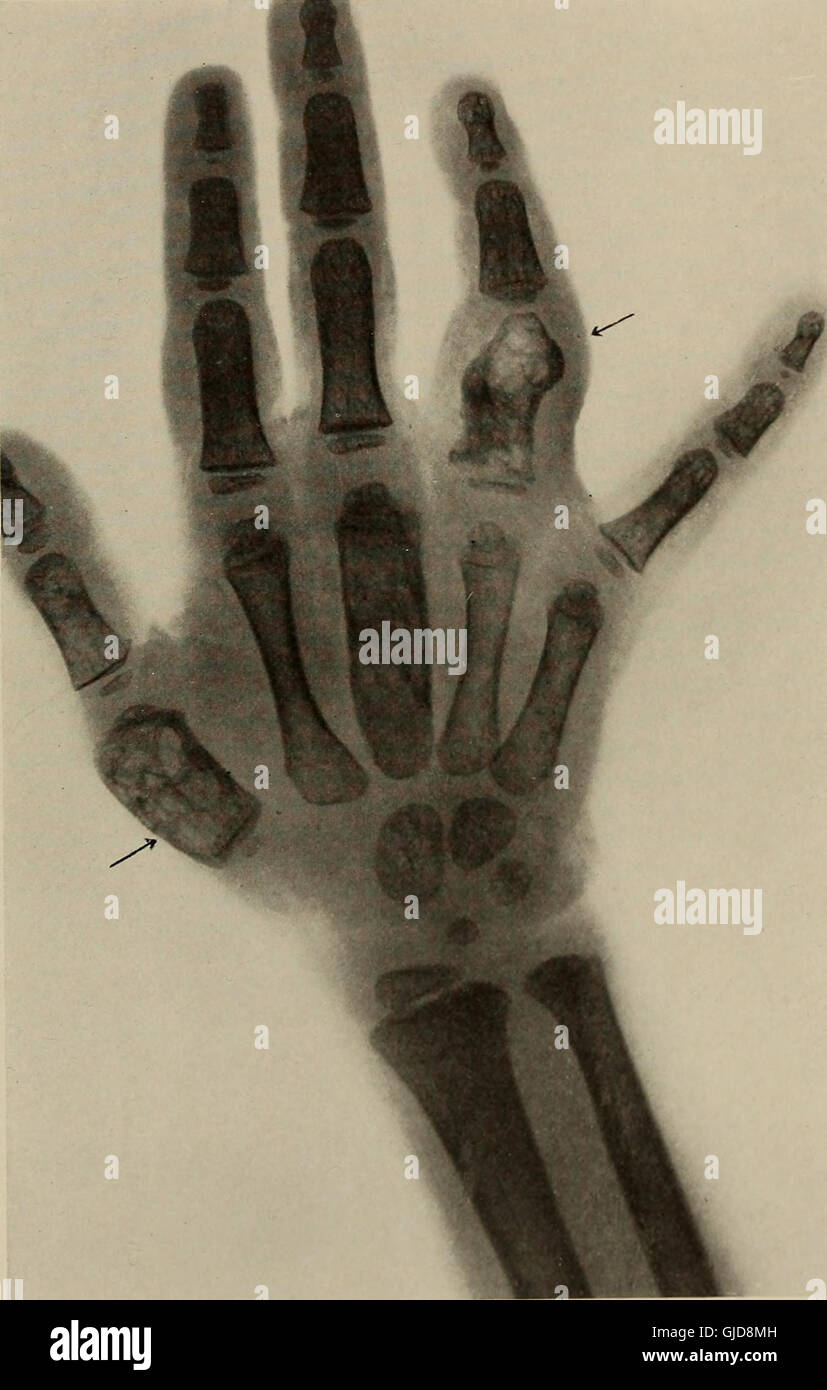 'Living Anatomy and Pathology' (1910) focuses on the study of human ...