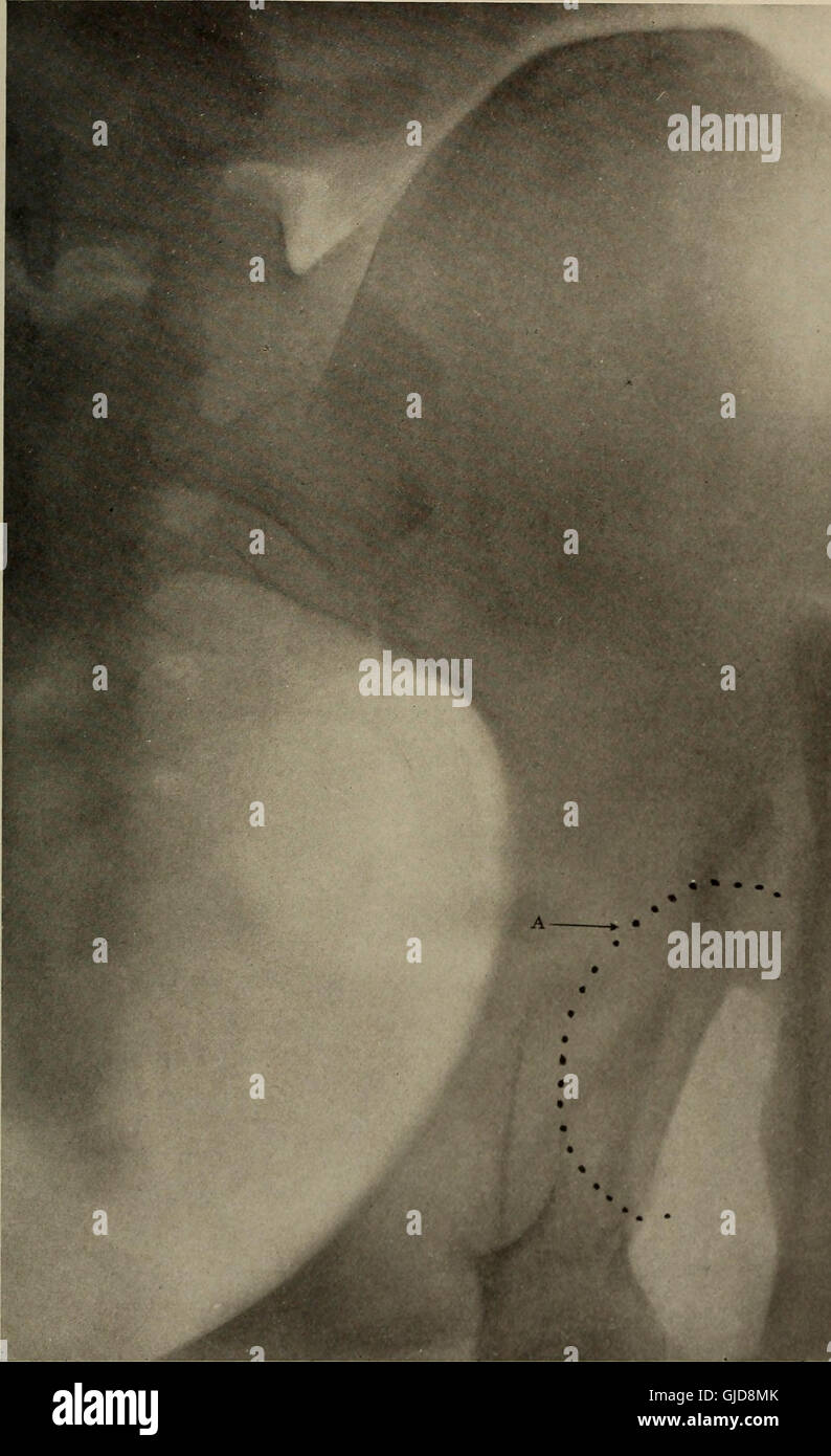 Detailed study anatomy pathological hi-res stock photography and images ...