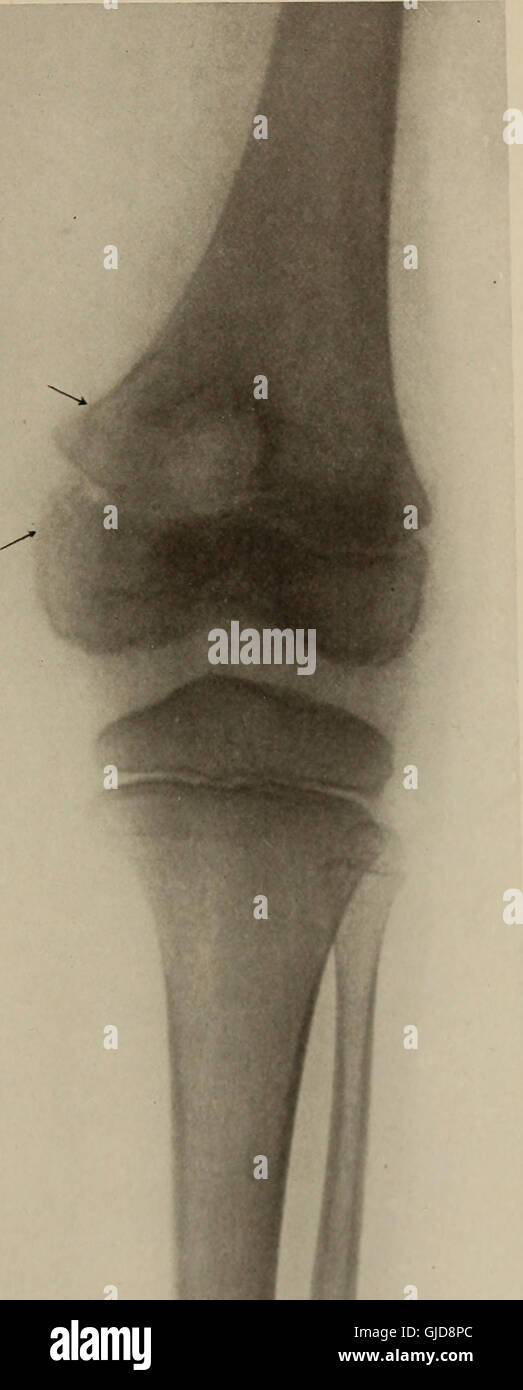 This 1910 work provides detailed insights into living anatomy and ...
