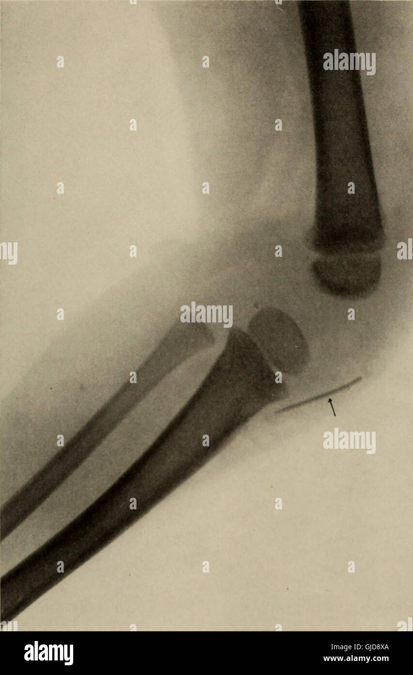 *Living Anatomy and Pathology* (1910) is a medical textbook focusing on ...