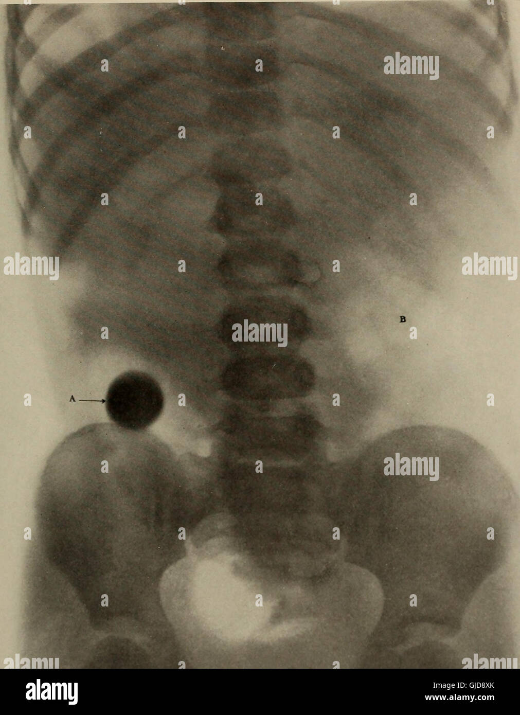 This work focuses on the detailed study of human anatomy and pathology ...