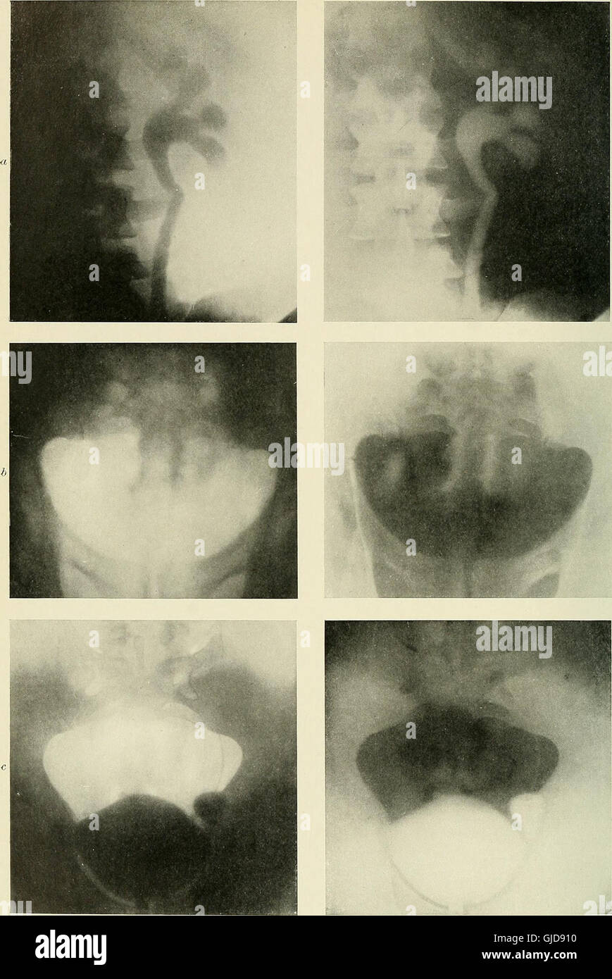 Radiography, x-ray therapeutics and radium therapy (1915 Stock Photo ...