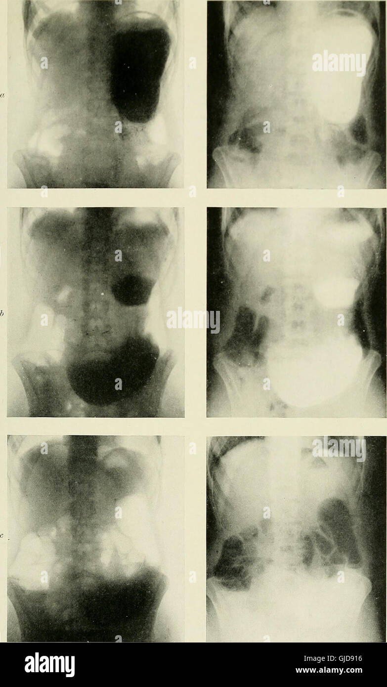 Radiography, x-ray therapeutics and radium therapy (1915 Stock Photo ...
