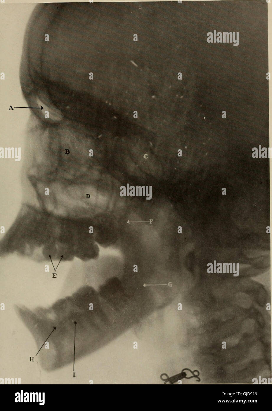 This image is from the 1910 edition of 'Living Anatomy and Pathology ...