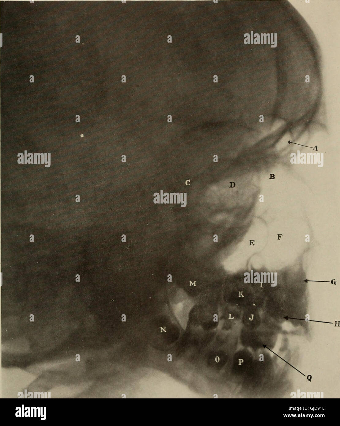 This 1910 work explores the study of living anatomy and pathology ...