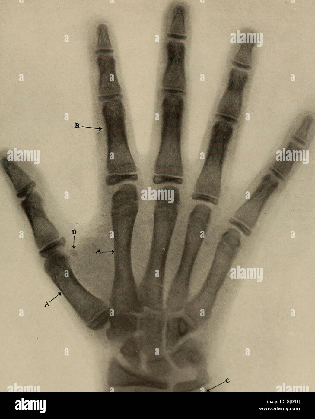 This 1910 work explores living anatomy and pathology, offering insights ...