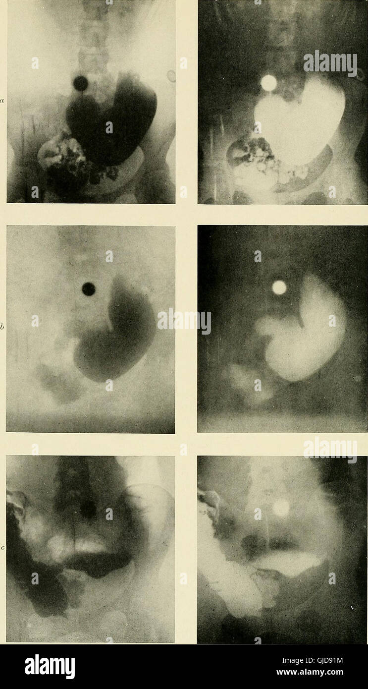 Radiography, x-ray therapeutics and radium therapy (1915 Stock Photo ...