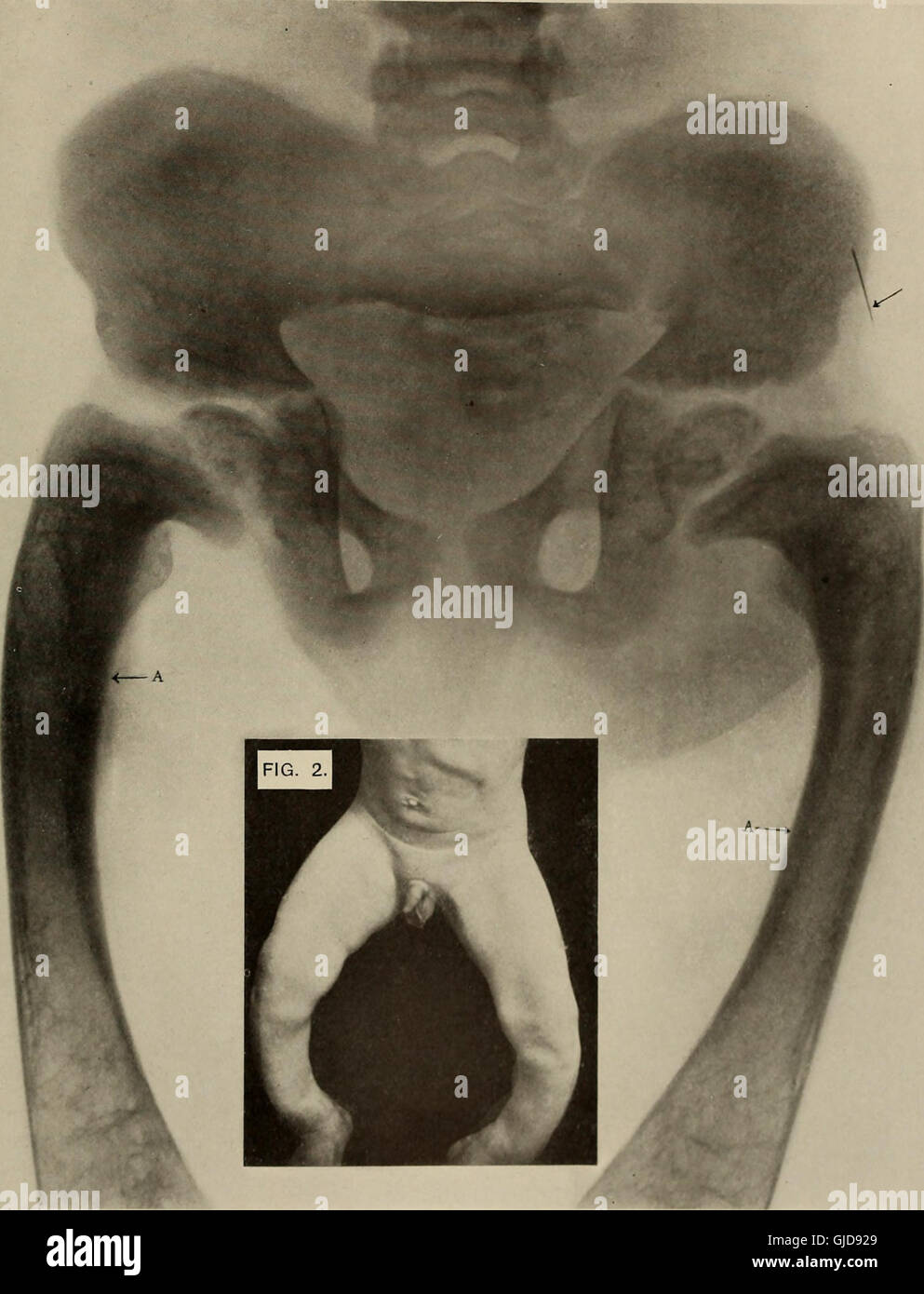 This 1910 text explores living anatomy and pathology, focusing on the ...