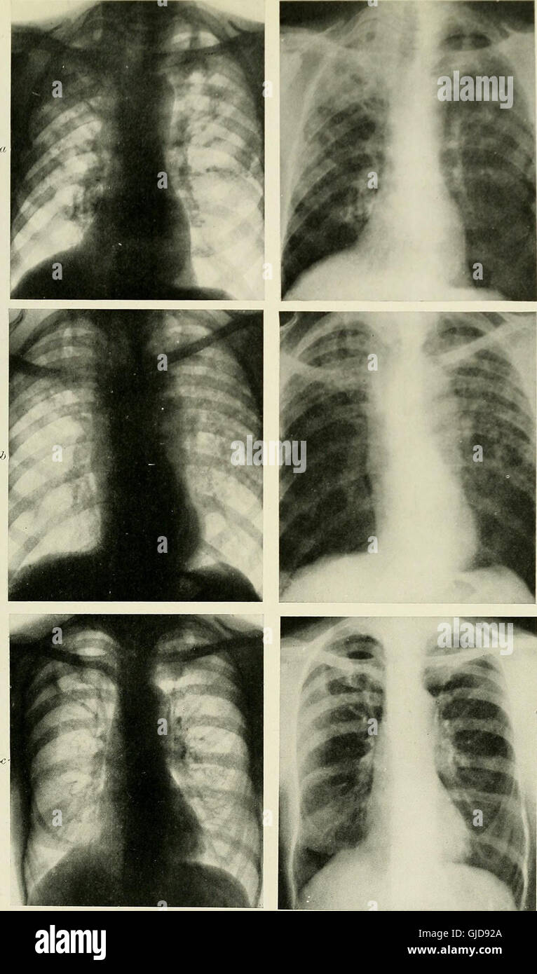 This image represents the 1915 publication 'Radiography, X-ray ...