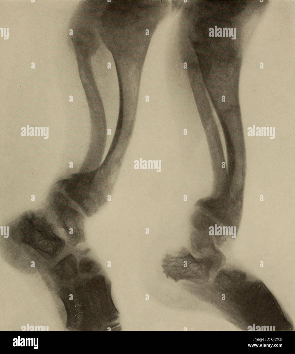 A 1910 text on living anatomy and pathology, providing detailed ...