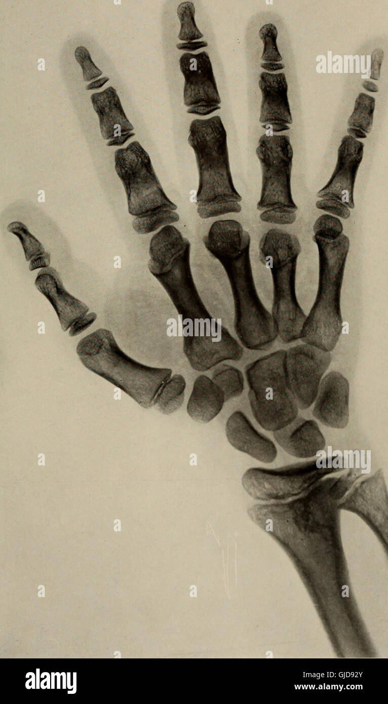 This 1910 work delves into the study of living anatomy and pathology ...