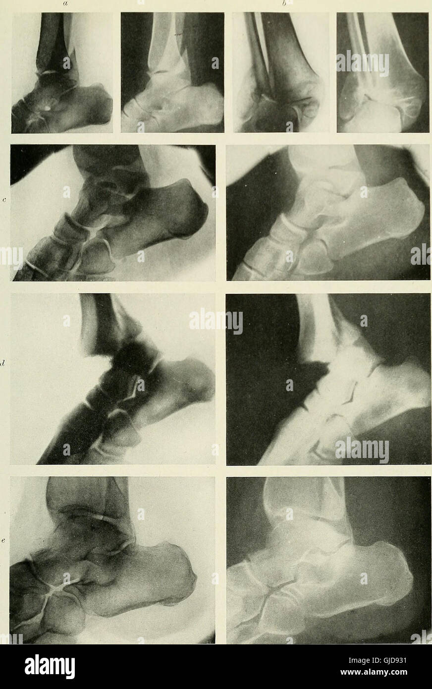 This 1915 work discusses the medical use of radiography, x-ray ...