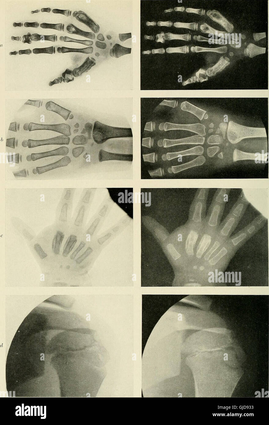 Radiography, x-ray therapeutics and radium therapy (1915 Stock Photo ...