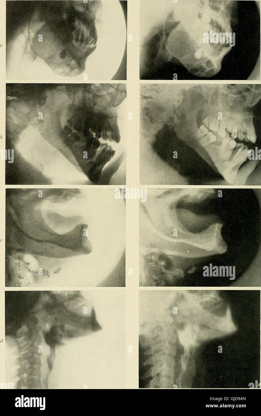 'Radiography, X-Ray Therapeutics, and Radium Therapy' (1915) covers the ...