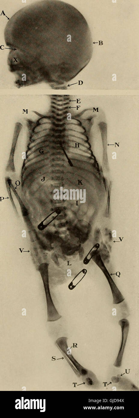 'Living Anatomy and Pathology' (1910) explores human anatomy and the ...