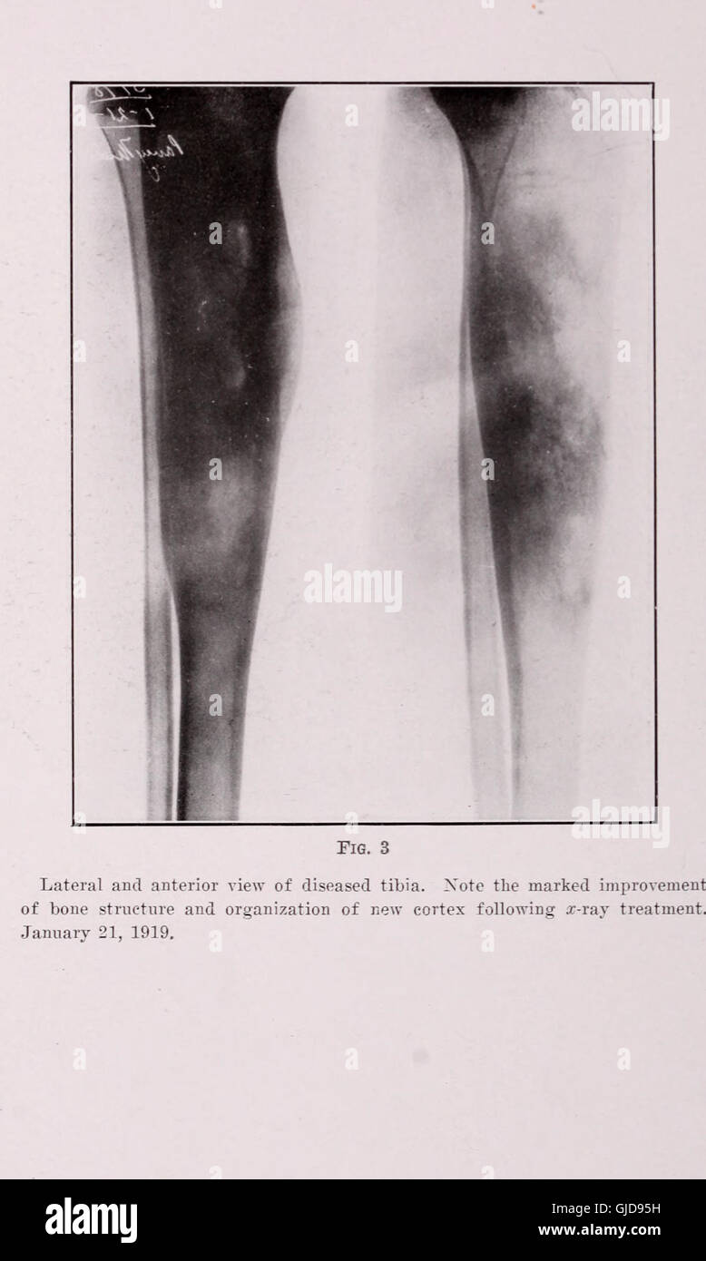 The 1921 'Journal of Radiology' covers early advancements and research ...