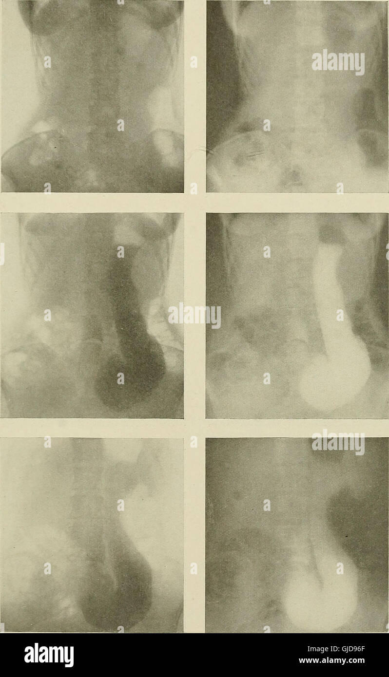 This work discusses the principles of radiography and its therapeutic ...