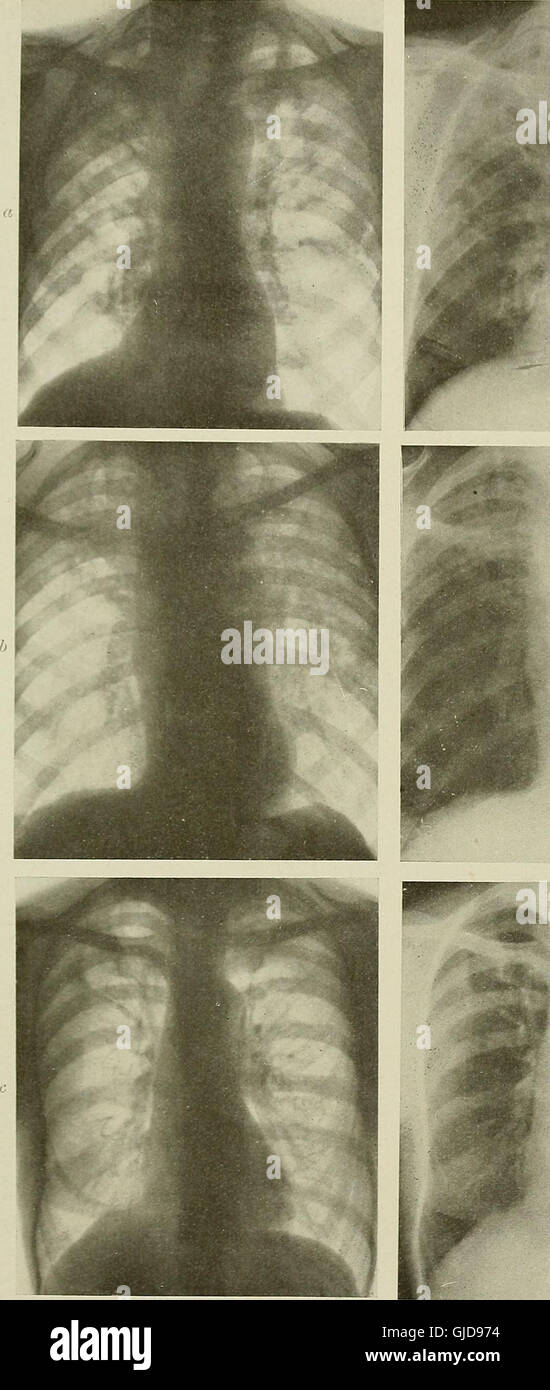 This 1919 work discusses the emerging field of radiography and its ...