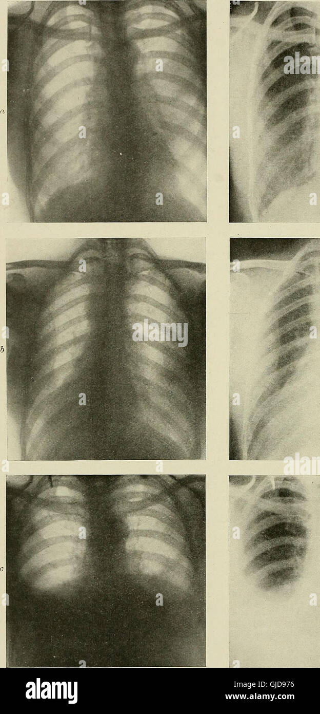 A 1919 work on radiography and radio-therapeutics, exploring the use of ...