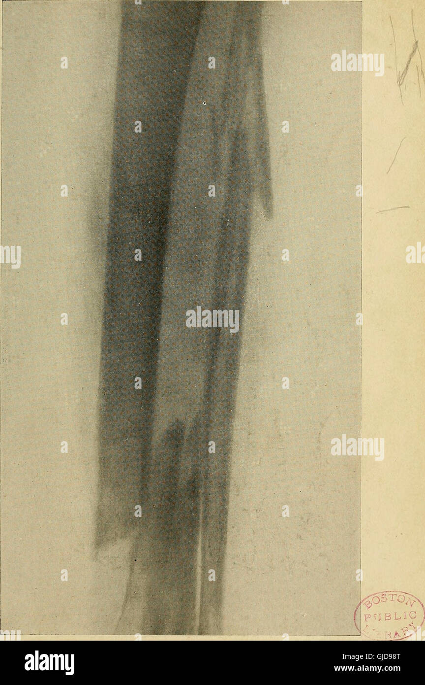 'The Roentgen Rays in Medicine and Surgery' (1901) explores the early ...