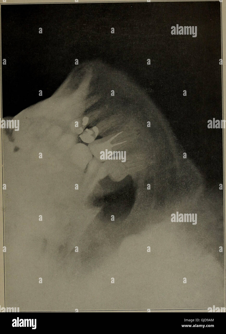 A 1913 study on the use of radiology in dentistry, explaining X-ray ...