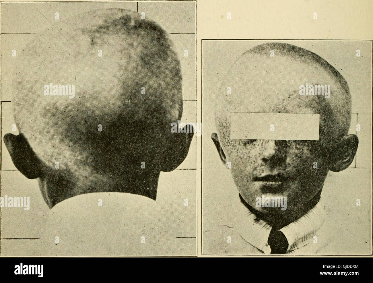 This manual of surgery, published in 1917, provides detailed guidance ...