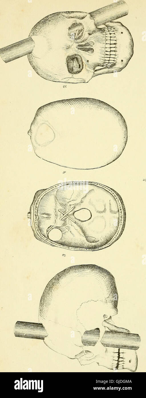 This 1852 medical text 'Operative Surgery Illustrated' features over ...