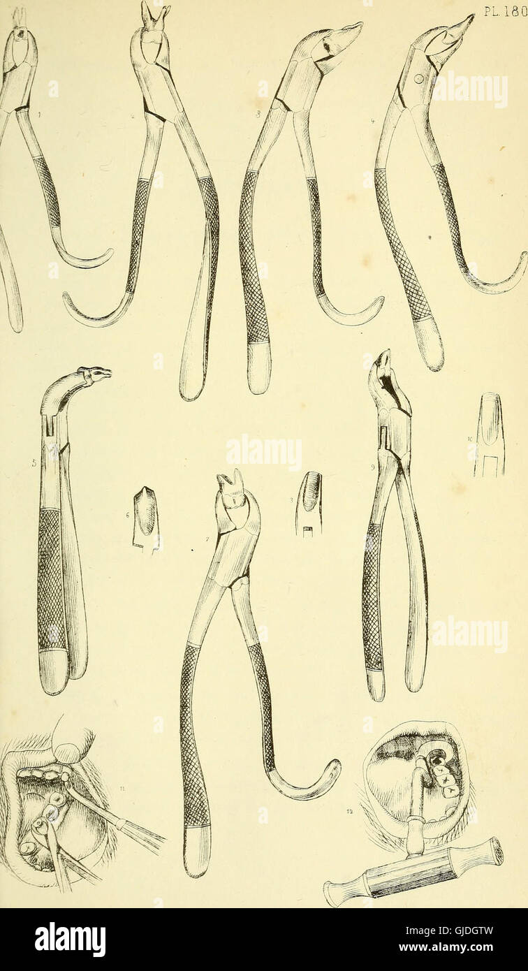 This 1852 work on operative surgery includes over 1,900 engravings and ...